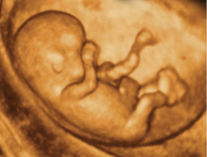 Galería de imagenes | Ultrasonic